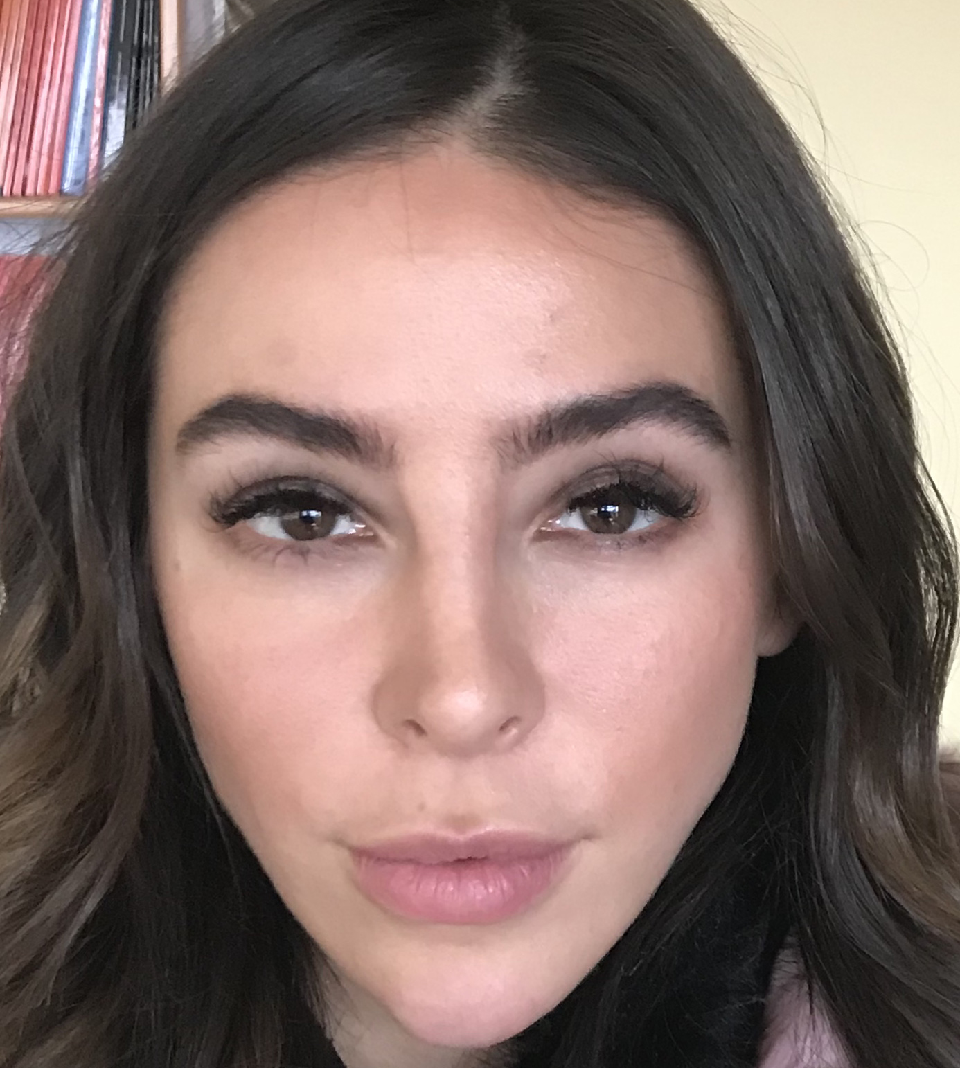 Change your eye color with Neoris - Discover our patients