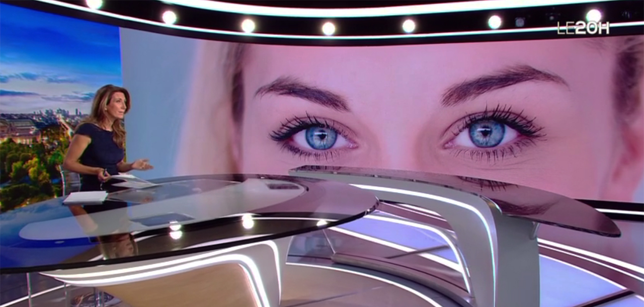 Testimonial: change your brown eyes into blue - Neoris