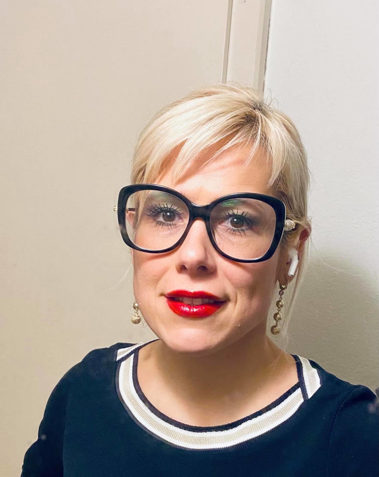 Change your eye color with Neoris - Discover our patients