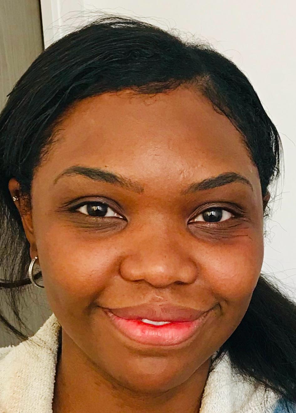 Change your eye color with Neoris - Discover our patients