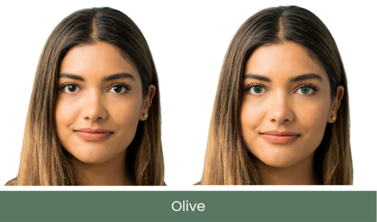 Eye color change before and after - Our keratopigmentation patients